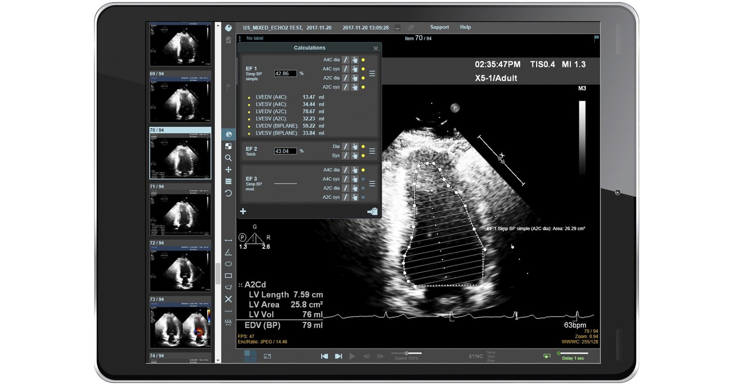 Studycast® System Breaks New Ground with Post-Exam Measurement ...