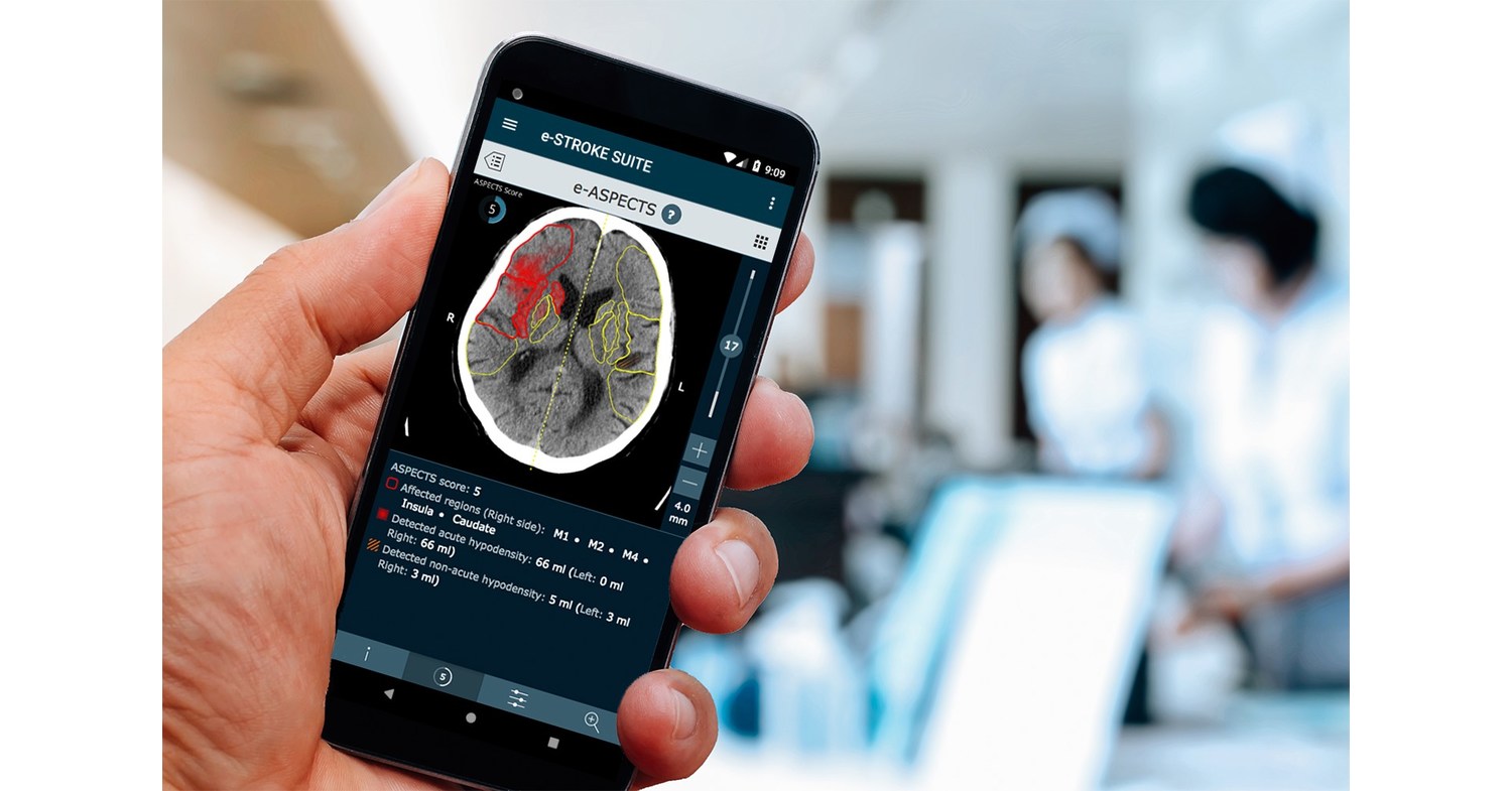 Using Simple Brain Scans Brainomix AI Software Can Generate Critical ...