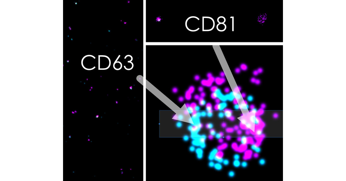 Kimera® Labs Receives FDA Phase I/IIa IND Approval For Its MSC Exosomes ...