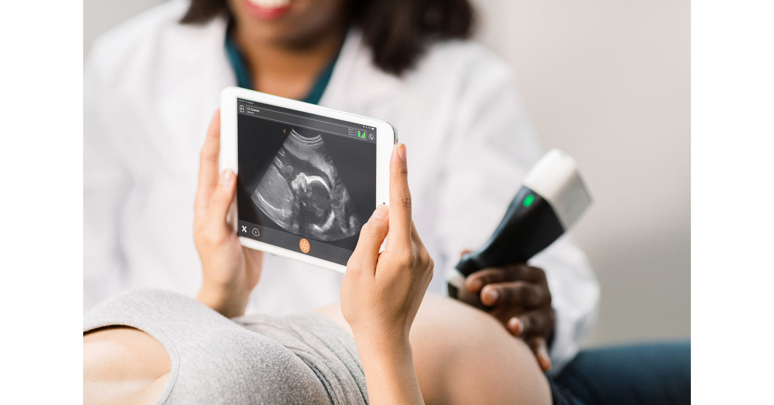 New Pocket Ultrasound Scanners Smaller, More Powerful, More Affordable