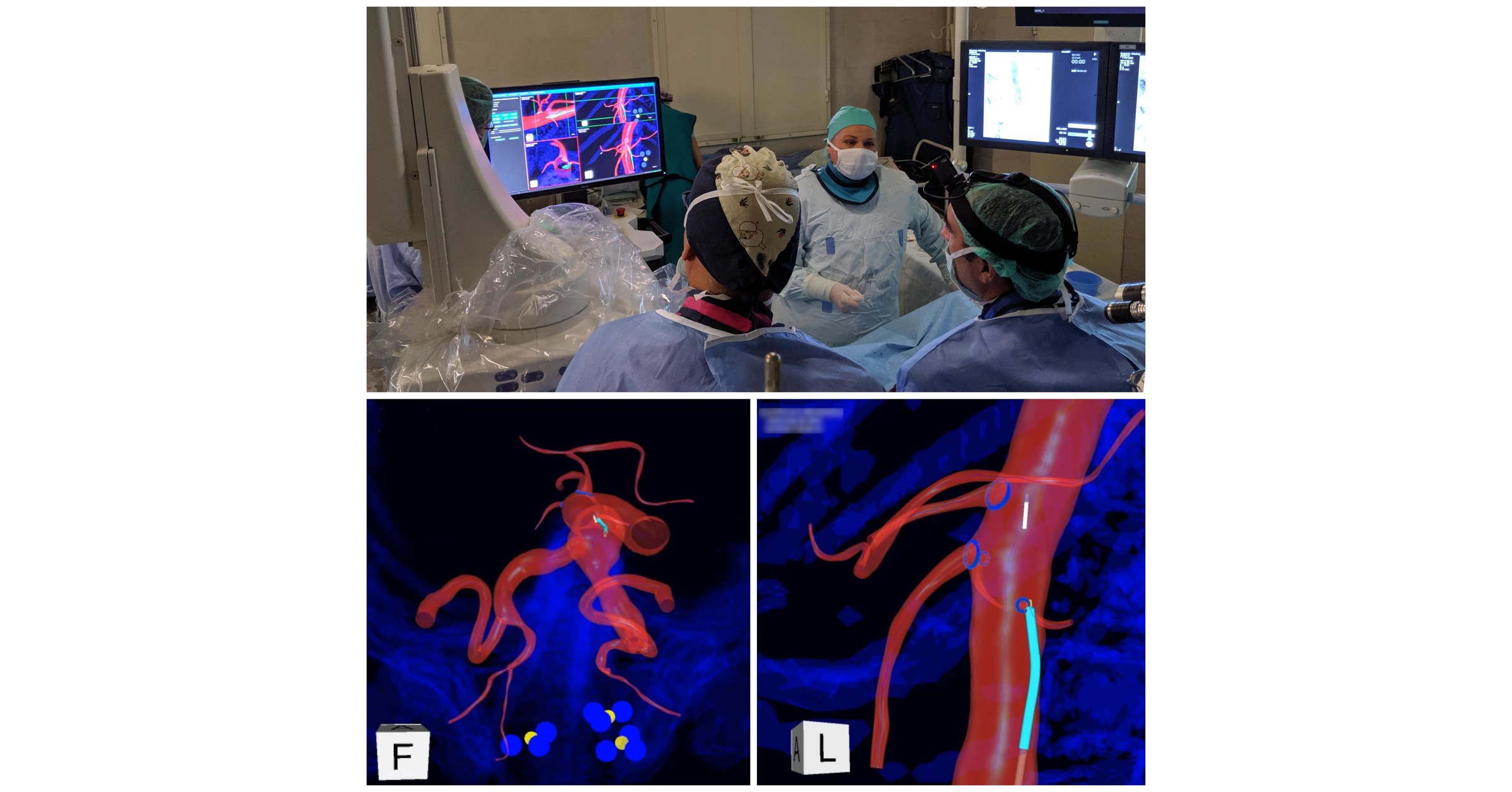 Centerline Biomedical Announces First-in-Human Use of IOPS™ Intra ...
