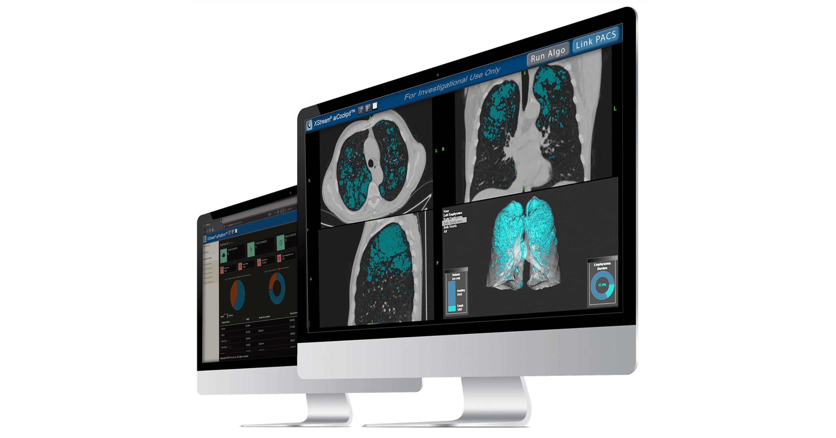 Fovia Ai Launches XStream® aiCockpit™ and XStream® aiPlatform™