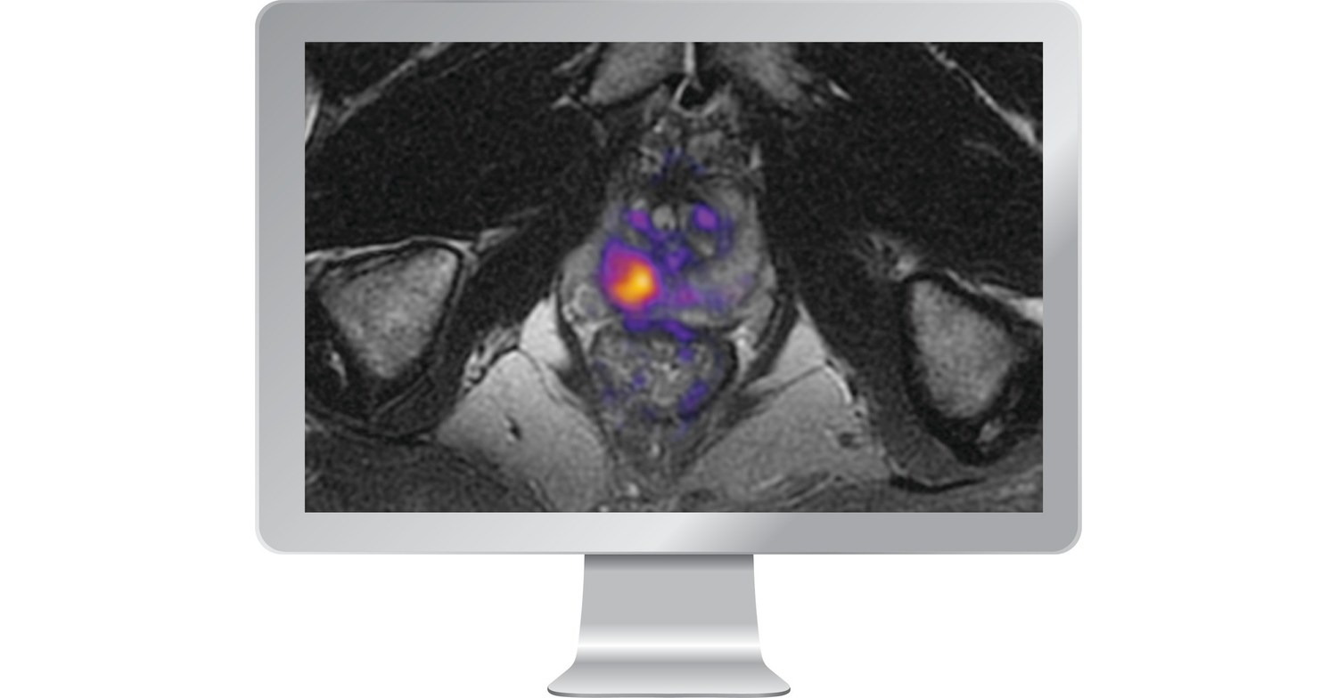 HealthLytix Receives FDA Clearance for Breakthrough Prostate Imaging ...