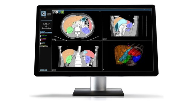 Together with NVIDIA CLARA, Fovia Ai Brings AI Annotation Tools to ...