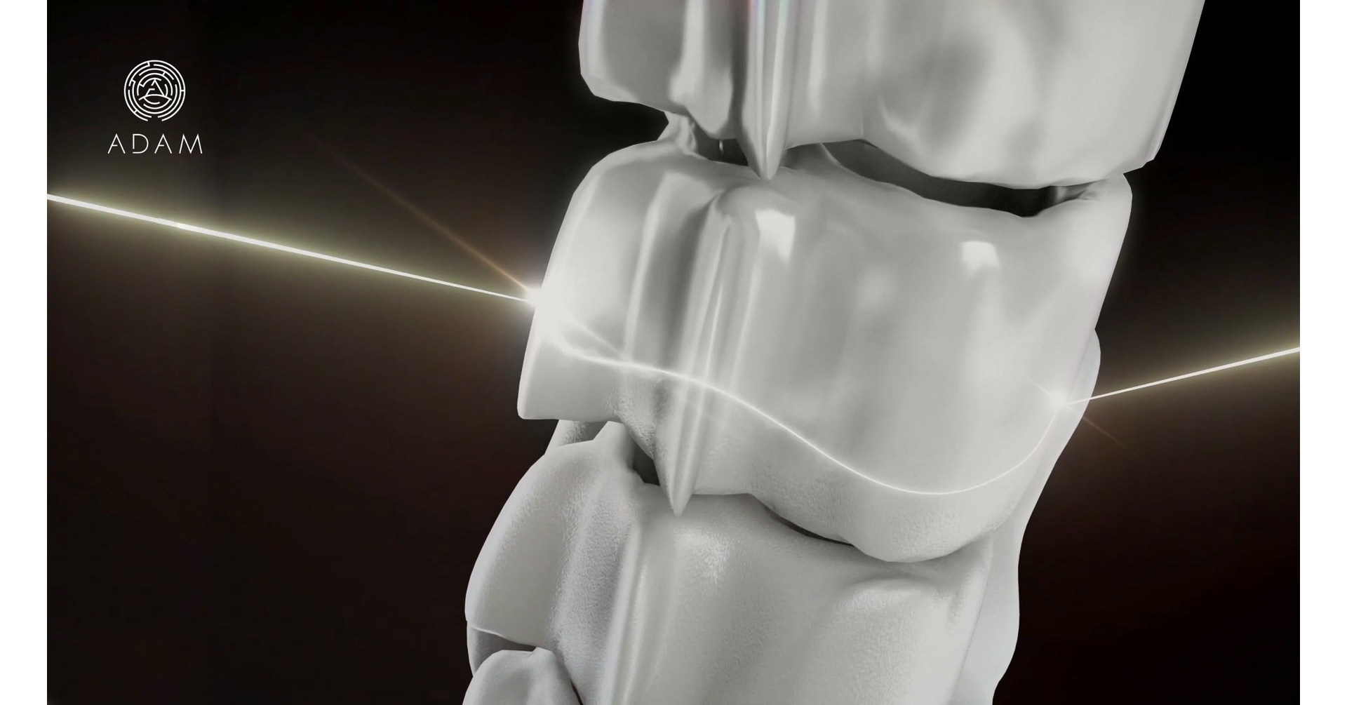 Graftless Bone Transplants Soon to Be Reality: ADAM Takes 3D Bones to ...