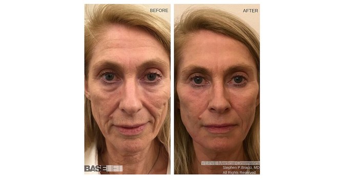 Verve Medical Cosmetics Celebrates 20 Years of Making NYC Beautiful