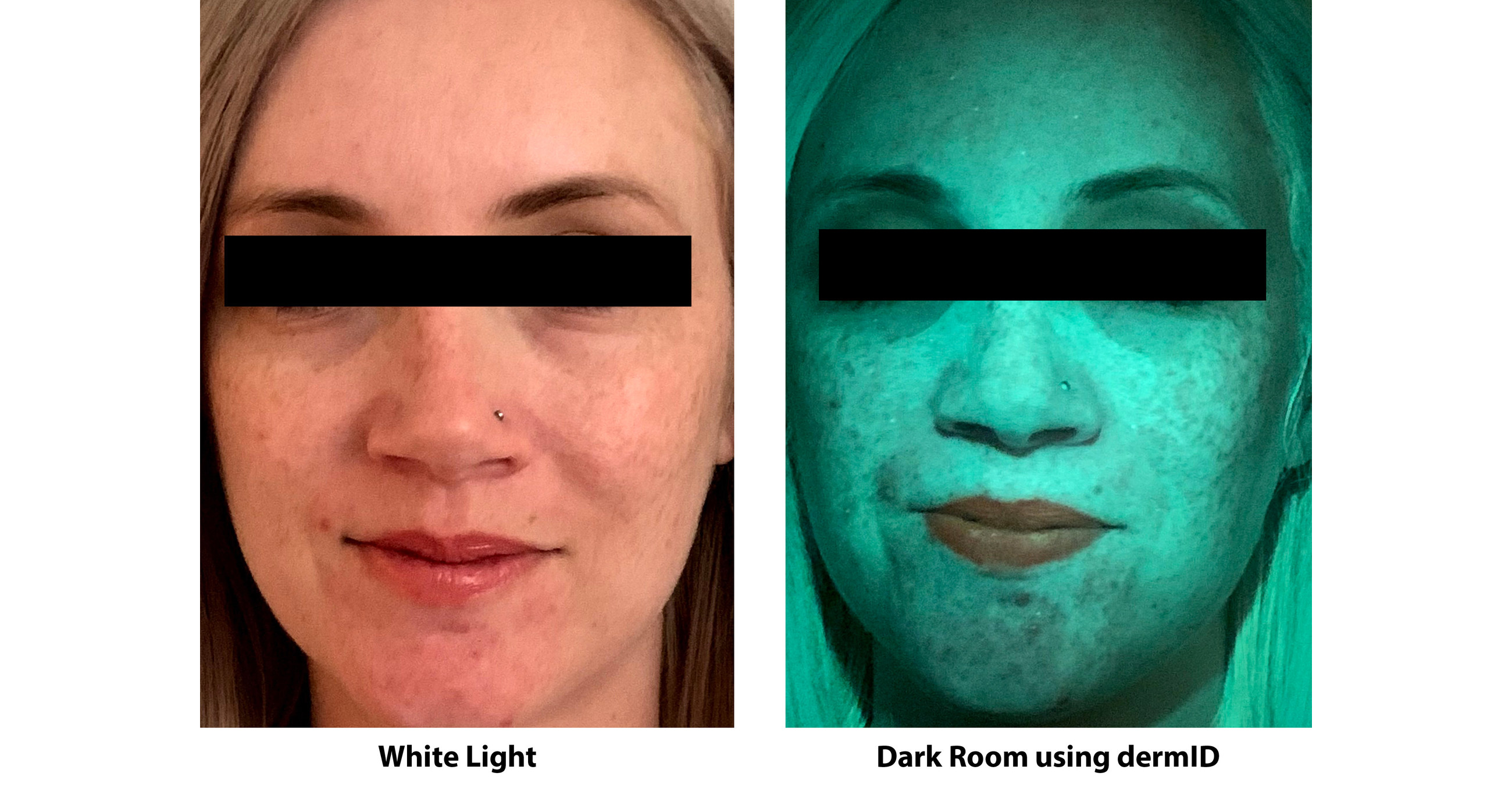 MDR Aesthetics Launches dermID, a Novel Skin Imaging Device to Aid in ...