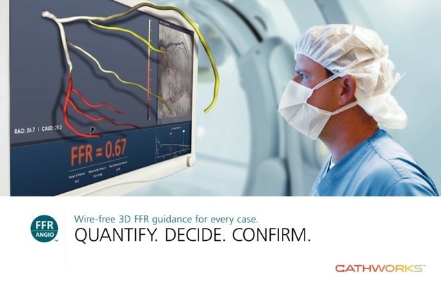 CathWorks FFRangio™ System Receives Regulatory Approval in Japan
