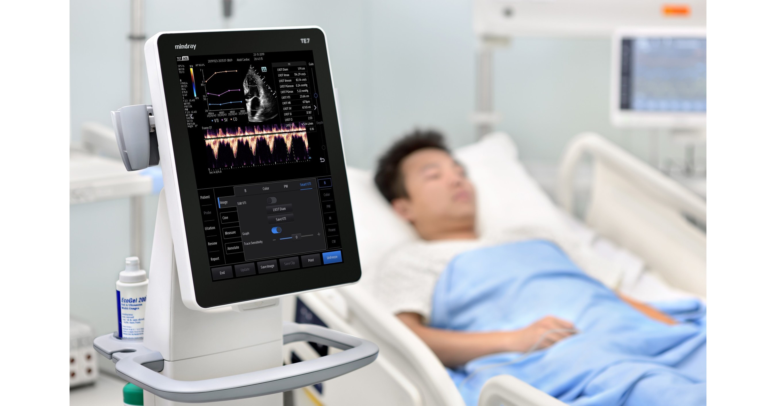 Mindray Launches New TE7 ACE Point-of-Care Solution to Improve ...