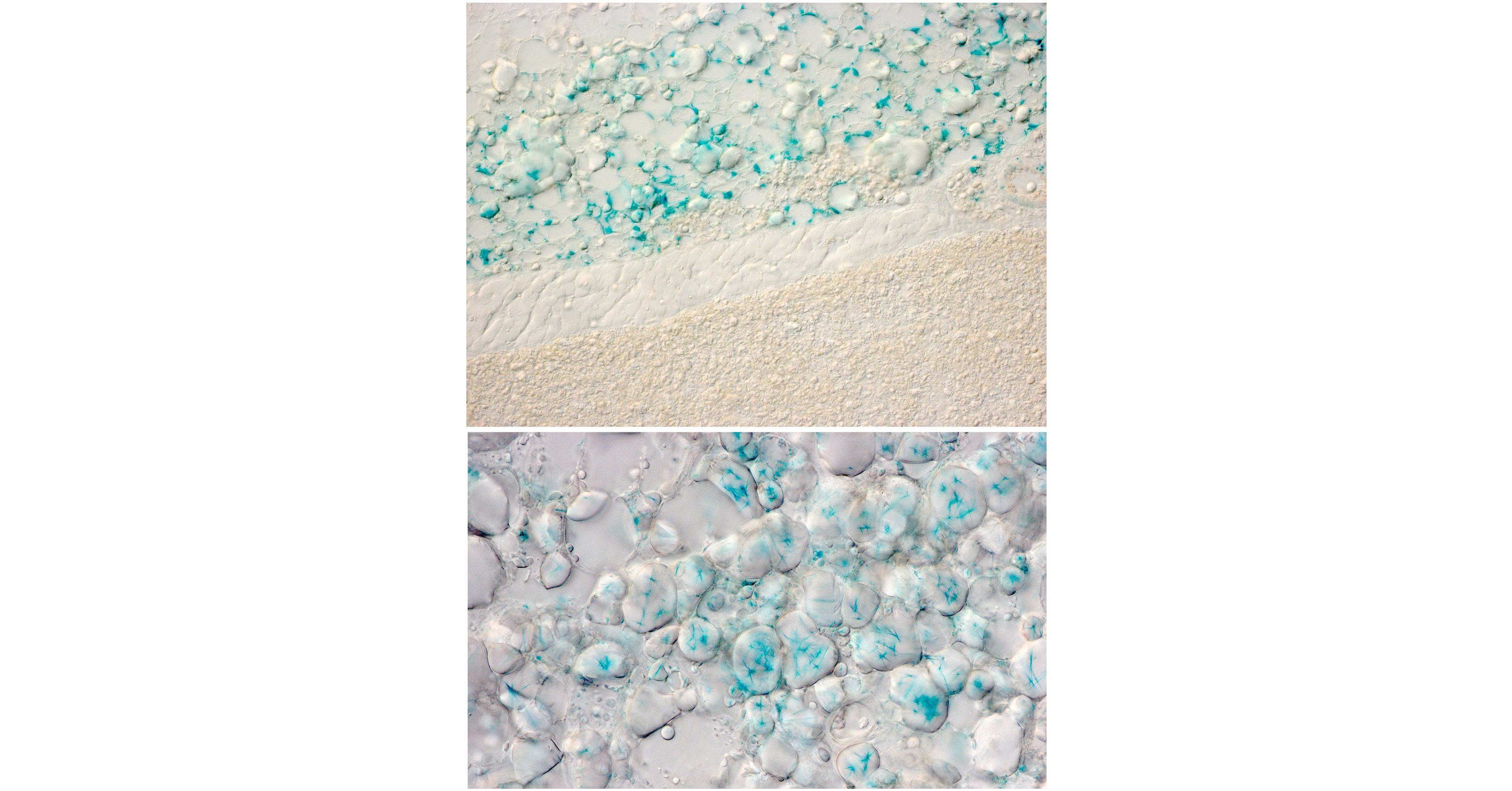 Fat Cells Can Sense Sunlight: Not Getting Enough Increases Metabolic ...