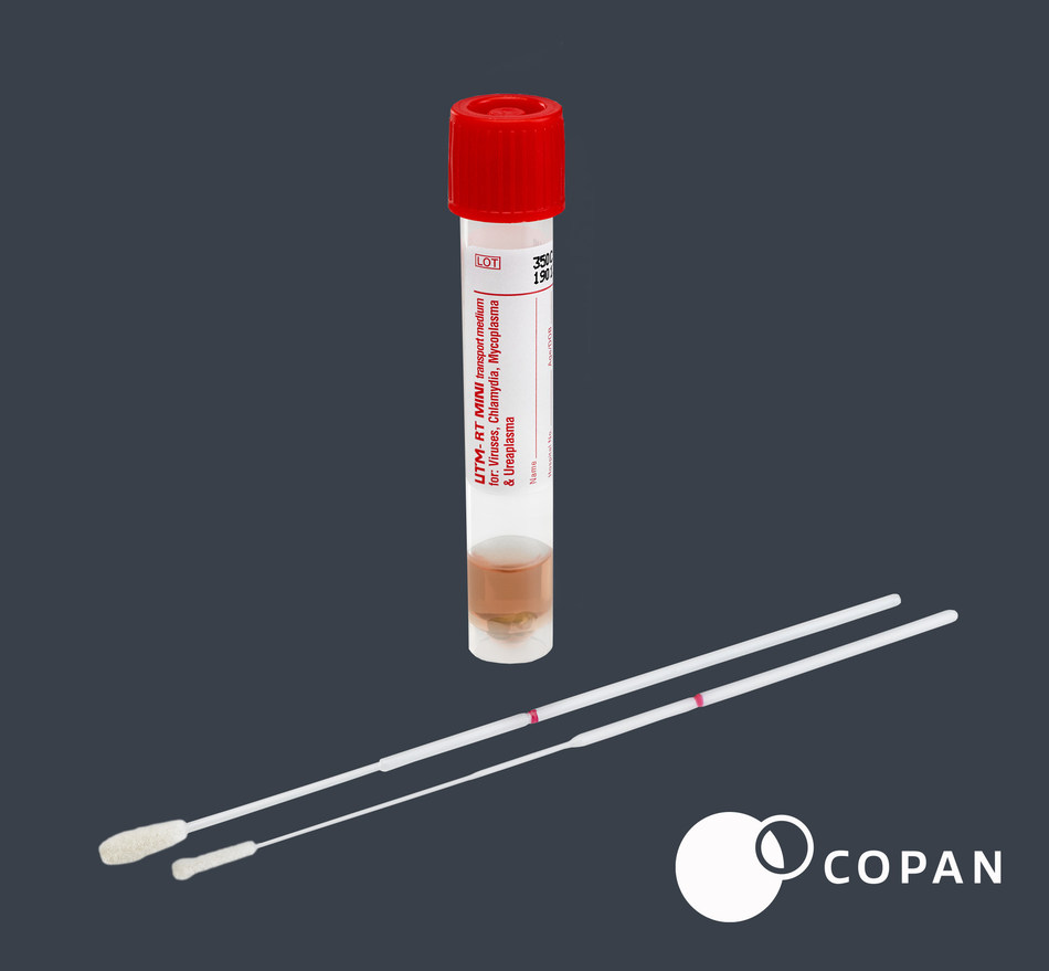 CDC Recommends Nasopharyngeal Swabs AND Oropharyngeal Swabs as Suitable ...