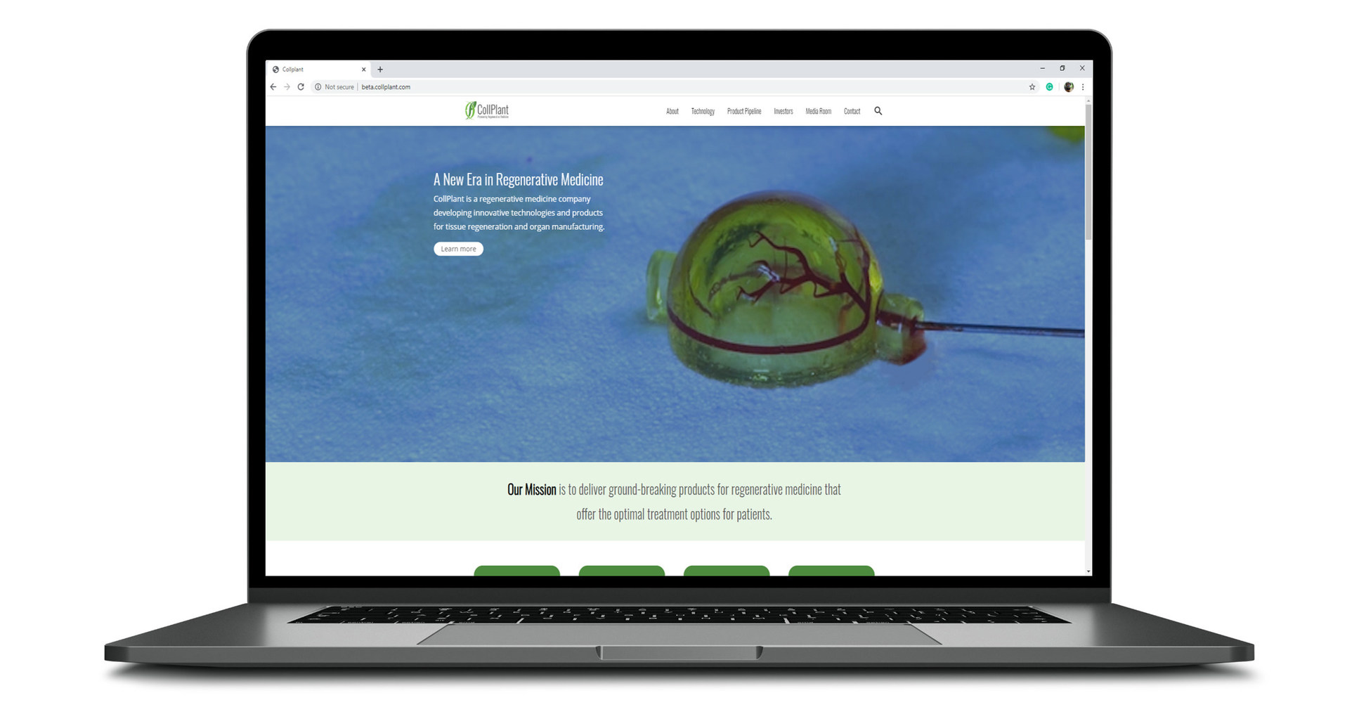 CollPlant Launches New Corporate Website to Showcase Recent ...