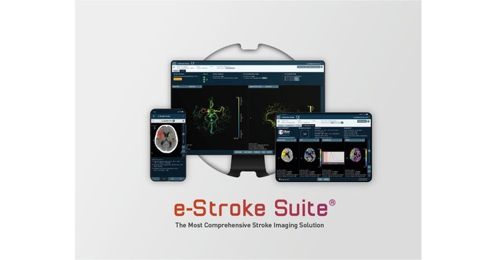 Brainomix Announces the Launch of Its New e-Stroke Suite 9.0