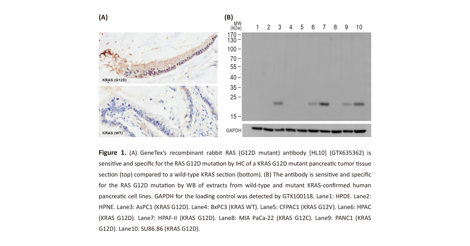 GeneTex Launches Novel Recombinant RAS (G12D Mutant) Antibody [HL10]