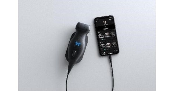 Butterfly iQ Now Approved by Health Canada