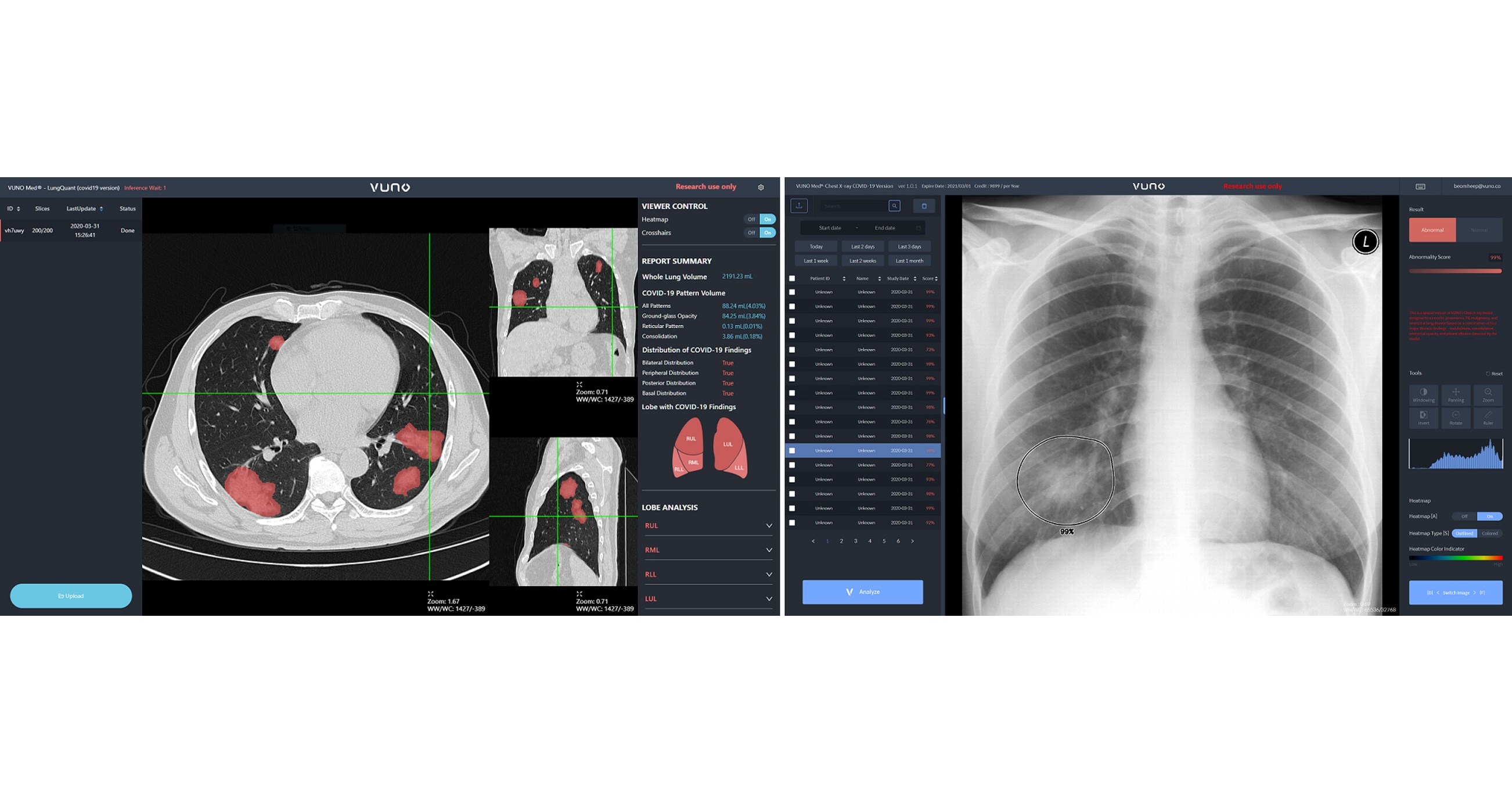 VUNO offers a suite of AI solutions in response to the COVID-19 ...