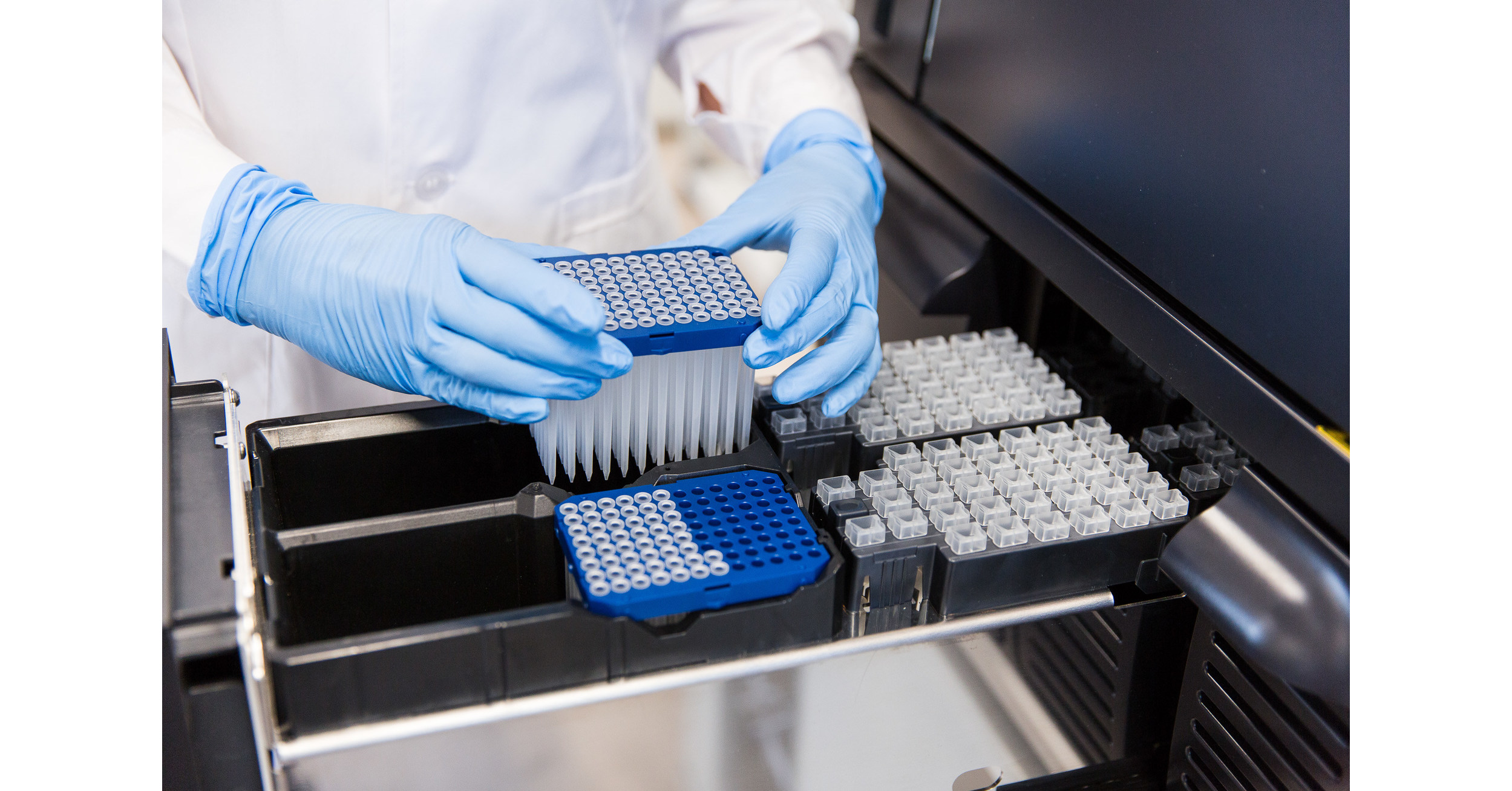 DiaSorin announces the launch of a fully automated serology test to ...