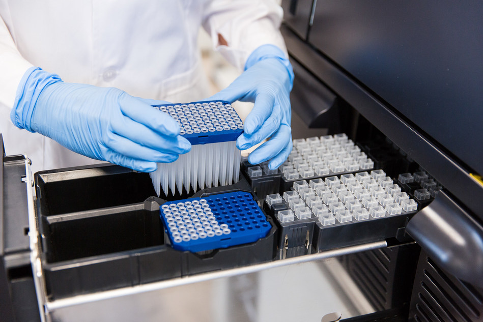 DiaSorin announces the launch of a fully automated serology test to ...