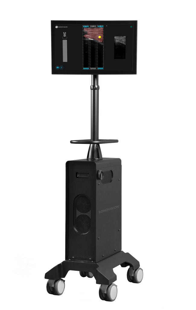 TDi™ | SonoVision™ Receives 510(k) Clearance for the First Machine ...