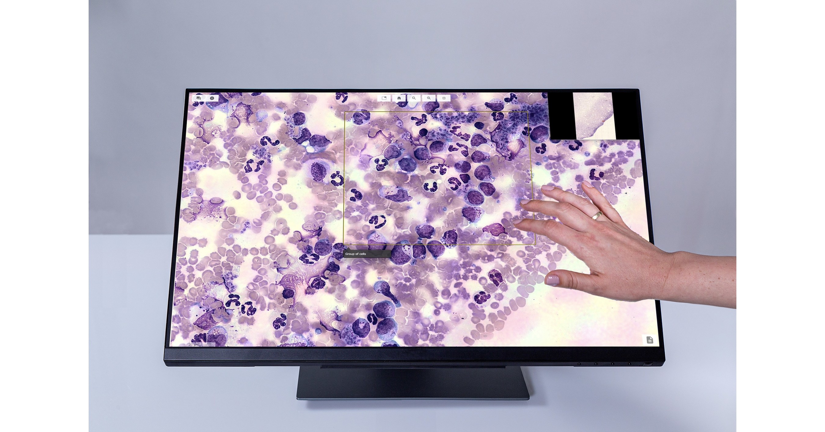 Scopio Labs Closes $16 Million Series B Round to Expand Commercial ...