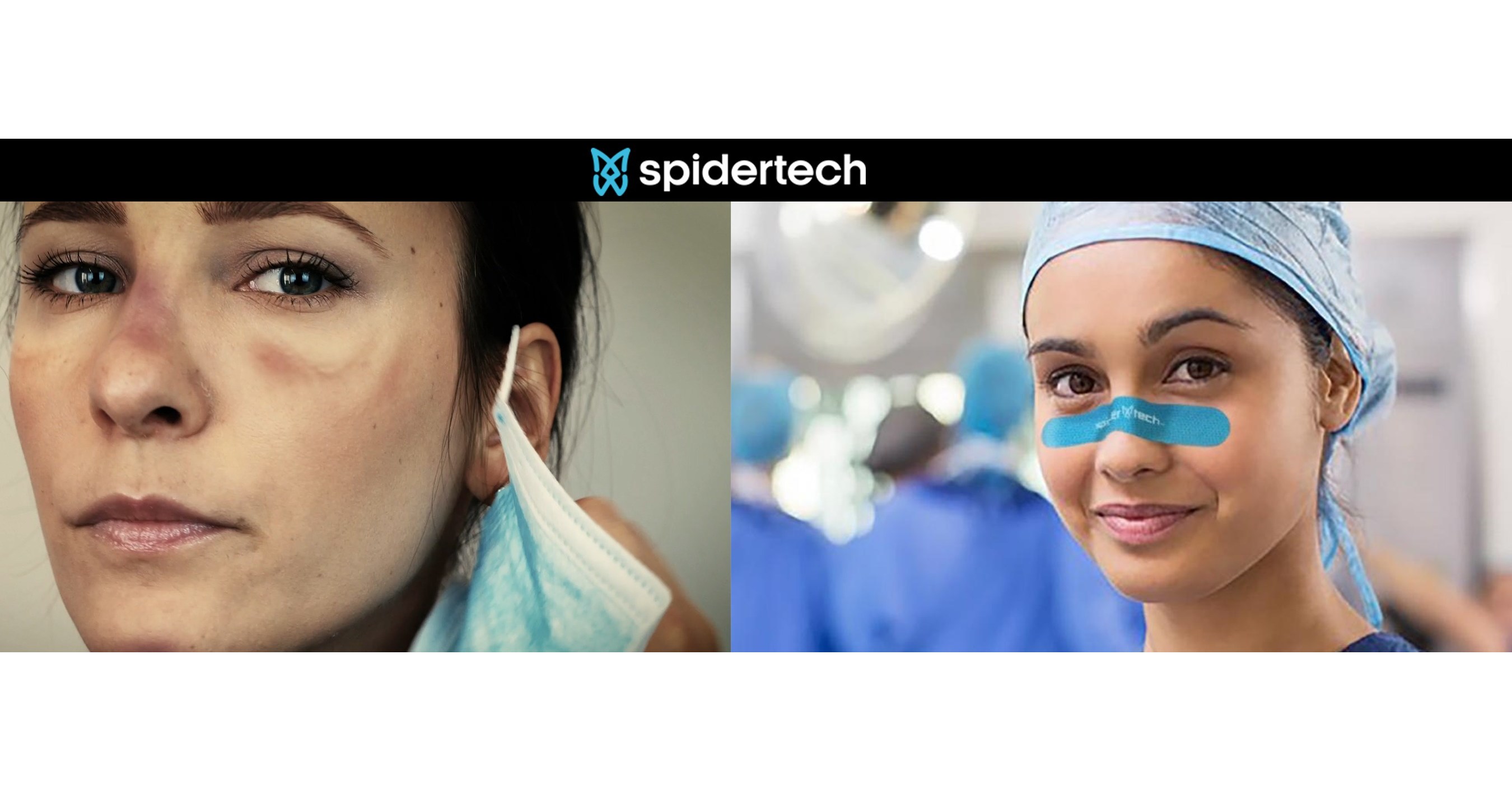 SpiderTech Continues its Advocacy for Face Mask Quality, Education and ...