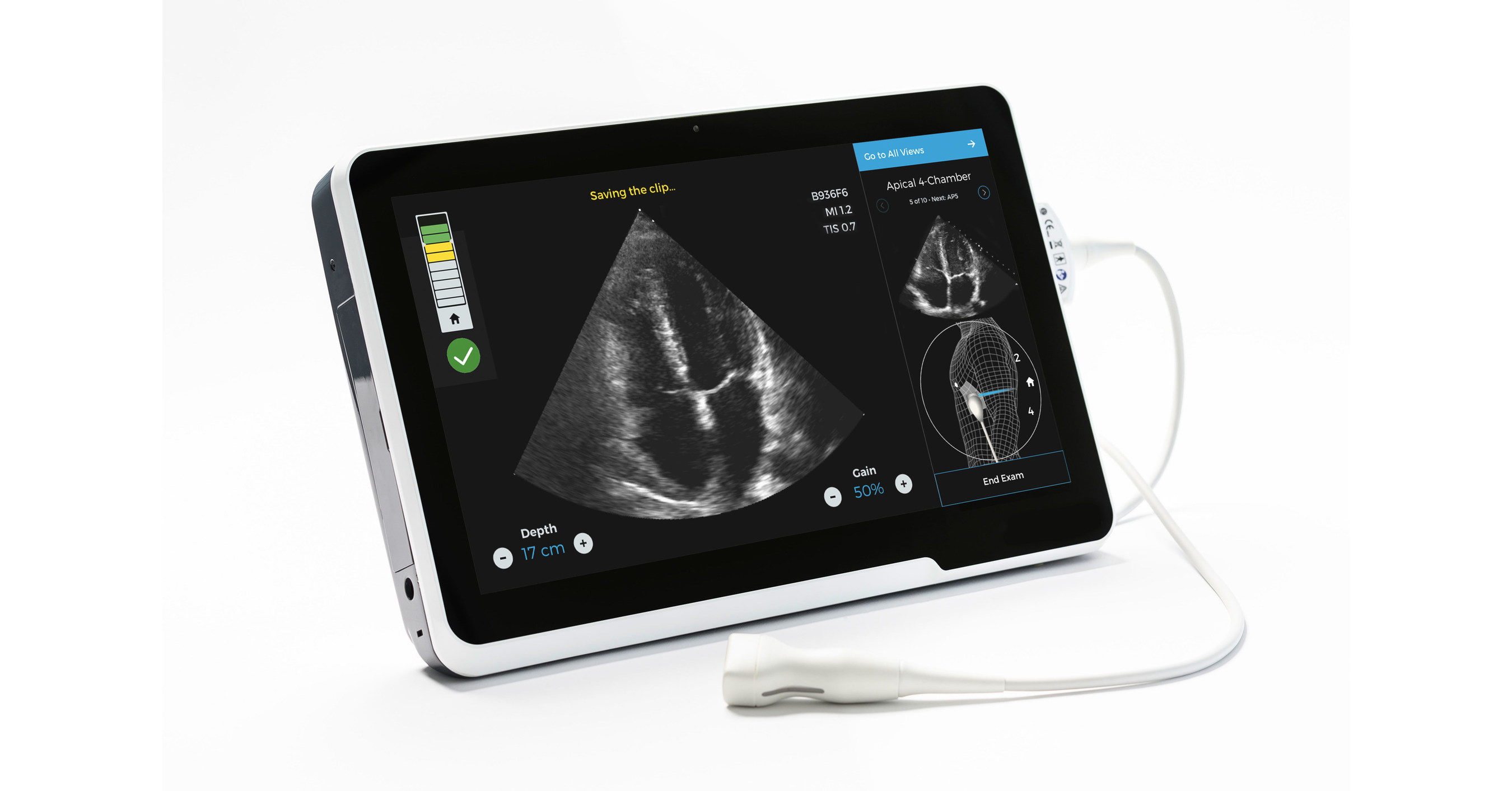 FDA Expedites Clearance of Caption Health Ultrasound Software to Aid ...