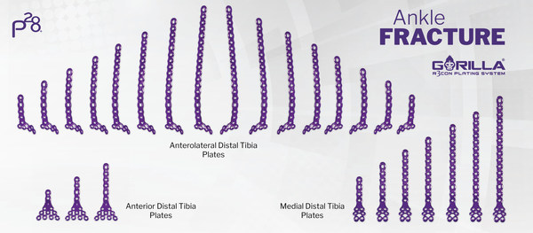 Paragon 28® Increases its Robust Ankle Fracture Offering - Gorilla ...