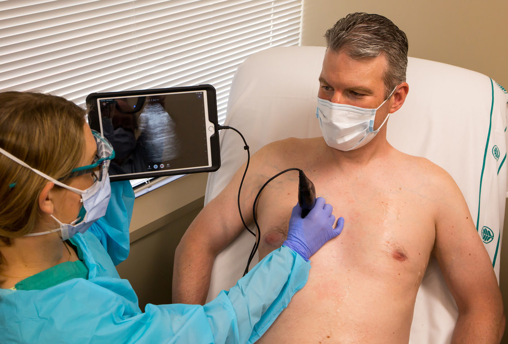 Atrium Health and Butterfly Network Drive Innovation in Medical Imaging ...