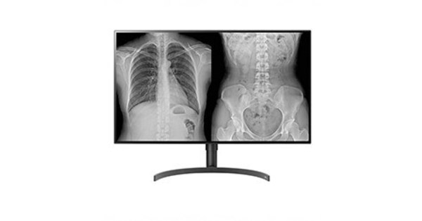 Shareden Imaging Solutions Now Delivering LG Radiology Displays with ...