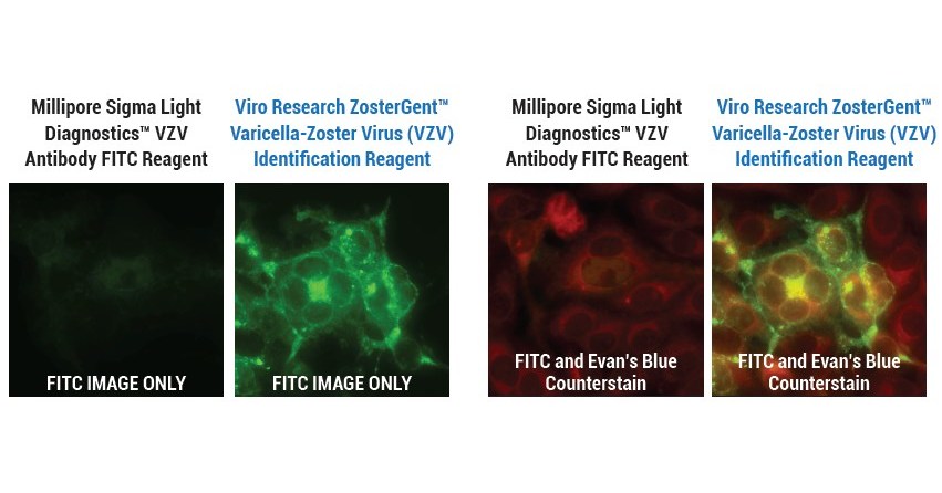 Inventor of Shingrix™ Develops New Chickenpox and Shingles Virus ...