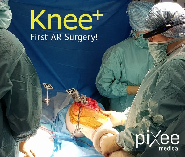 First Knee Replacement Surgery Successfully Completed Using Augmented ...
