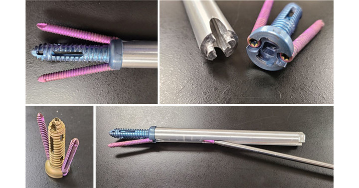 Inspired Spine Introducing New Technology to Revolutionize SI Joint ...