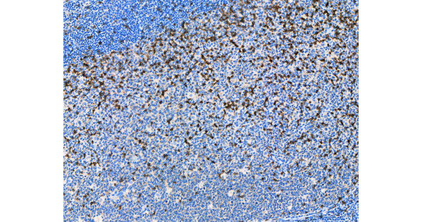 Biocare Medical and Bethyl Laboratories Announce the Launch of TIGIT ...