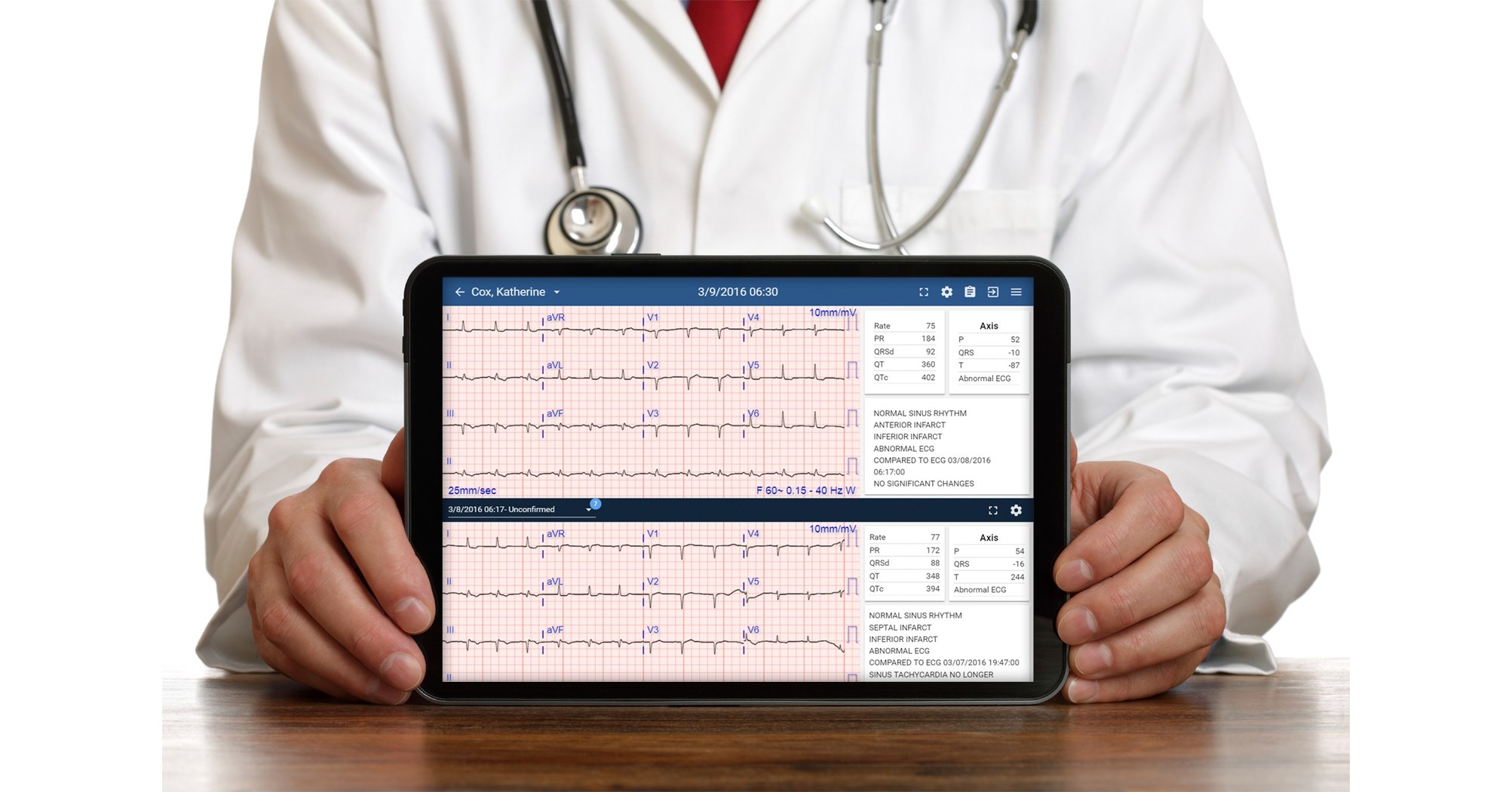 Over 1,000 Hospitals Worldwide Choose Epiphany Healthcare for ECG ...