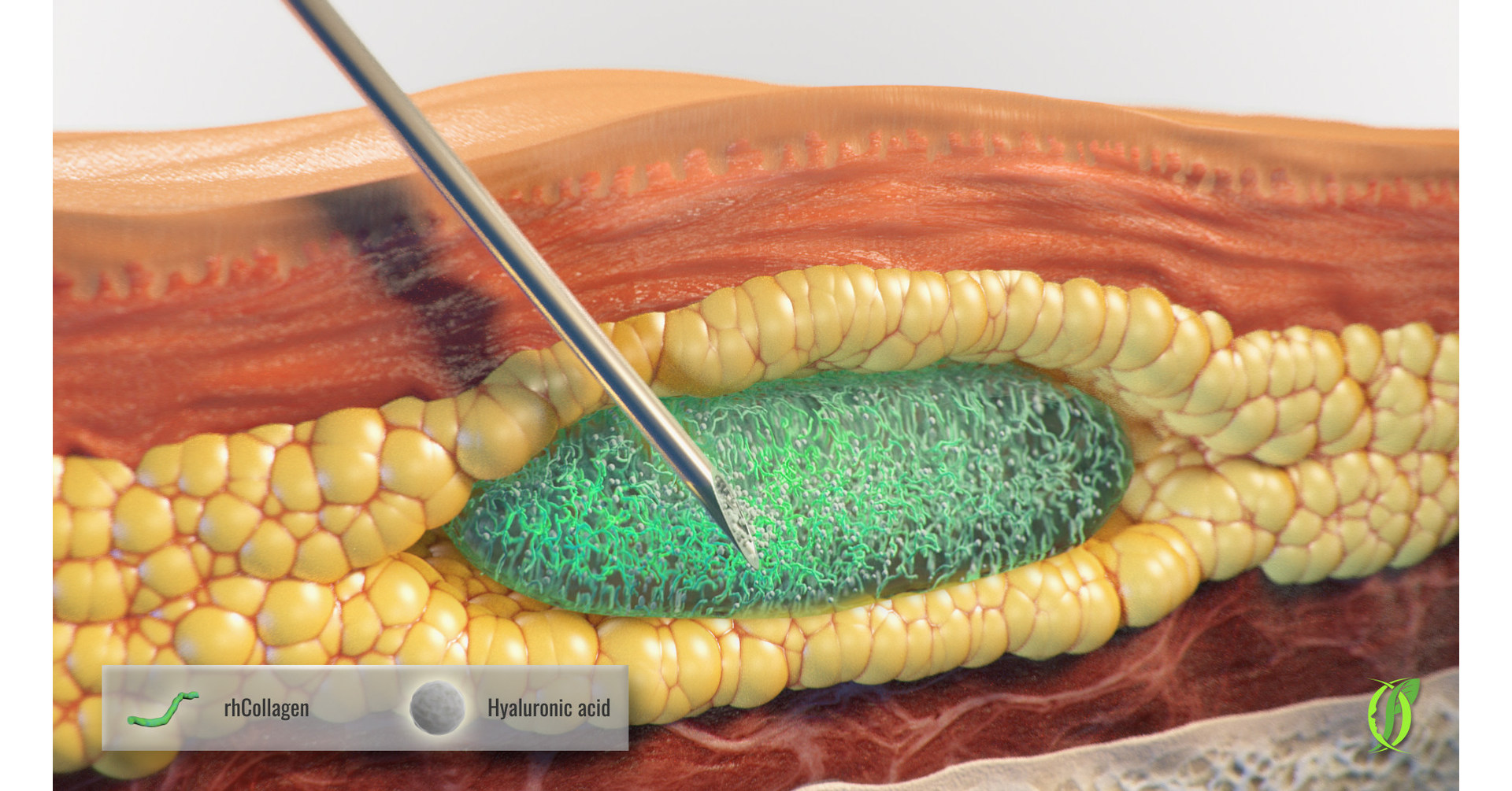 CollPlant Biotechnologies to Present at Science of Aging Virtual ...