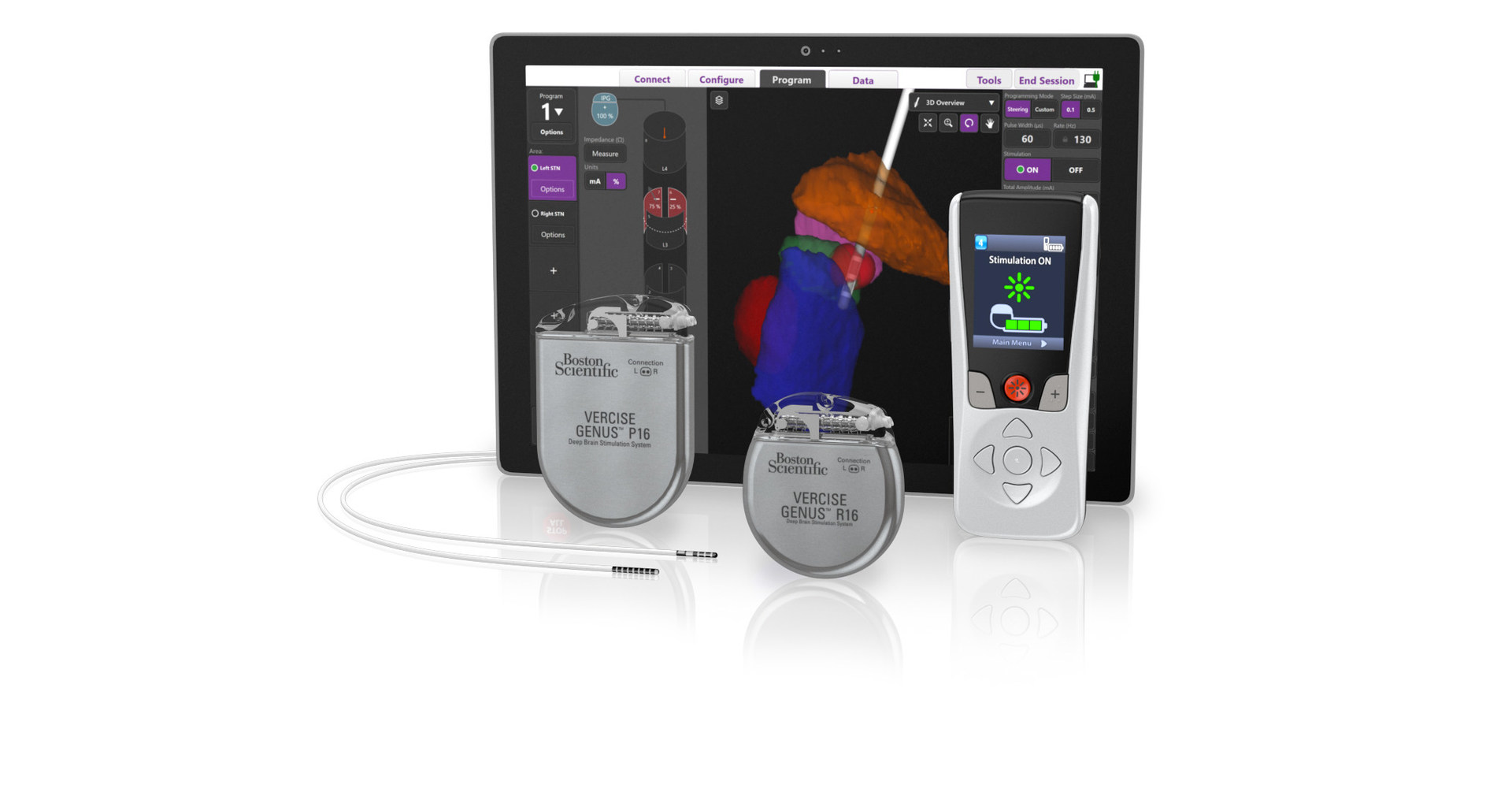 Boston Scientific Launches Vercise Genus™ DBS System In Europe