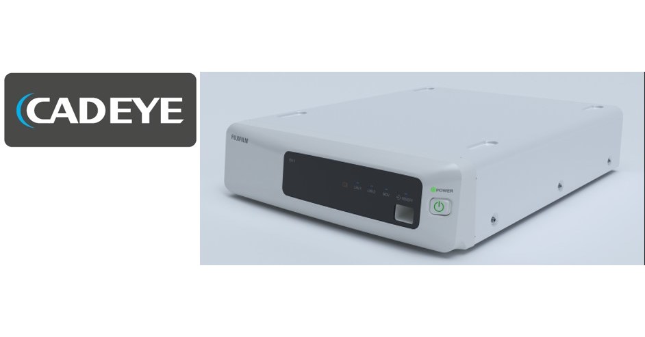 Fujifilm's new CAD EYE™ function for real time colon polyp Detection ...
