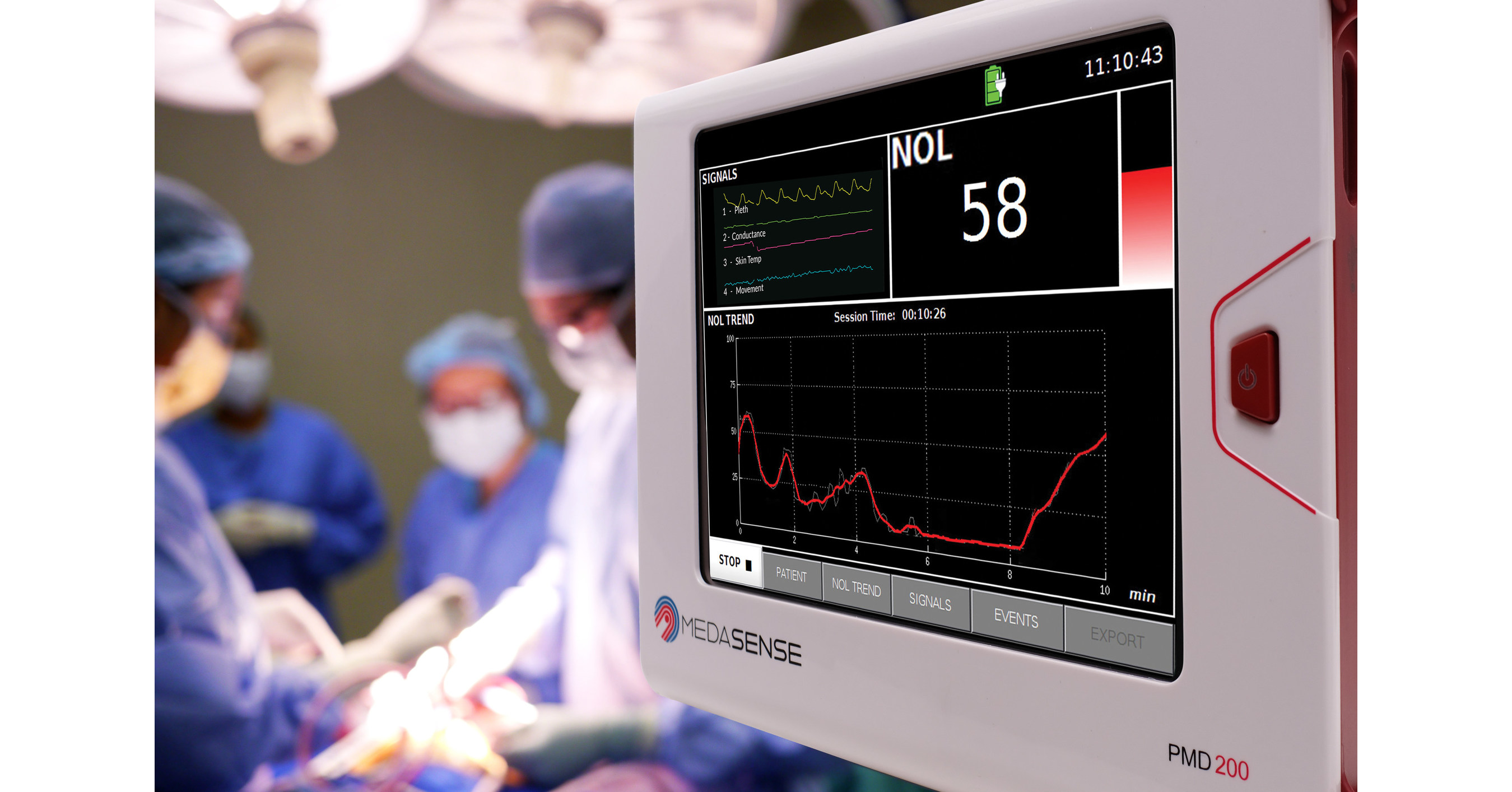 New Study: Postoperative Pain Can Be Reduced by Using NOL Monitoring to ...