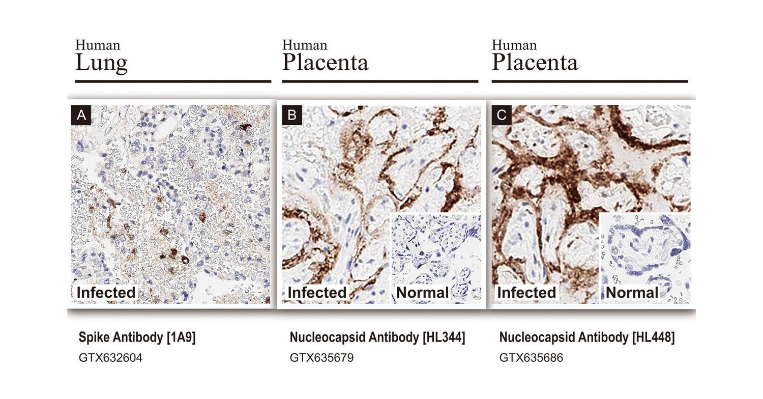 GeneTex SARS-CoV-2 Nucleocapsid and Spike Antibodies Independently ...