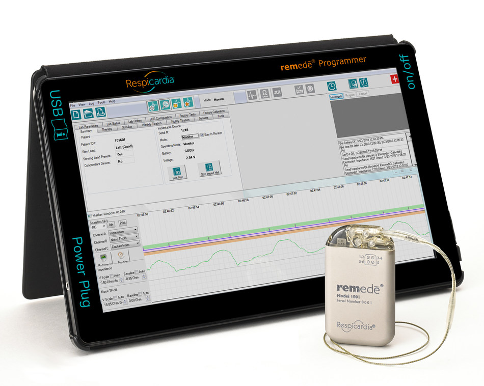 Transvenous phrenic nerve stimulation (The remedē System) shows ...