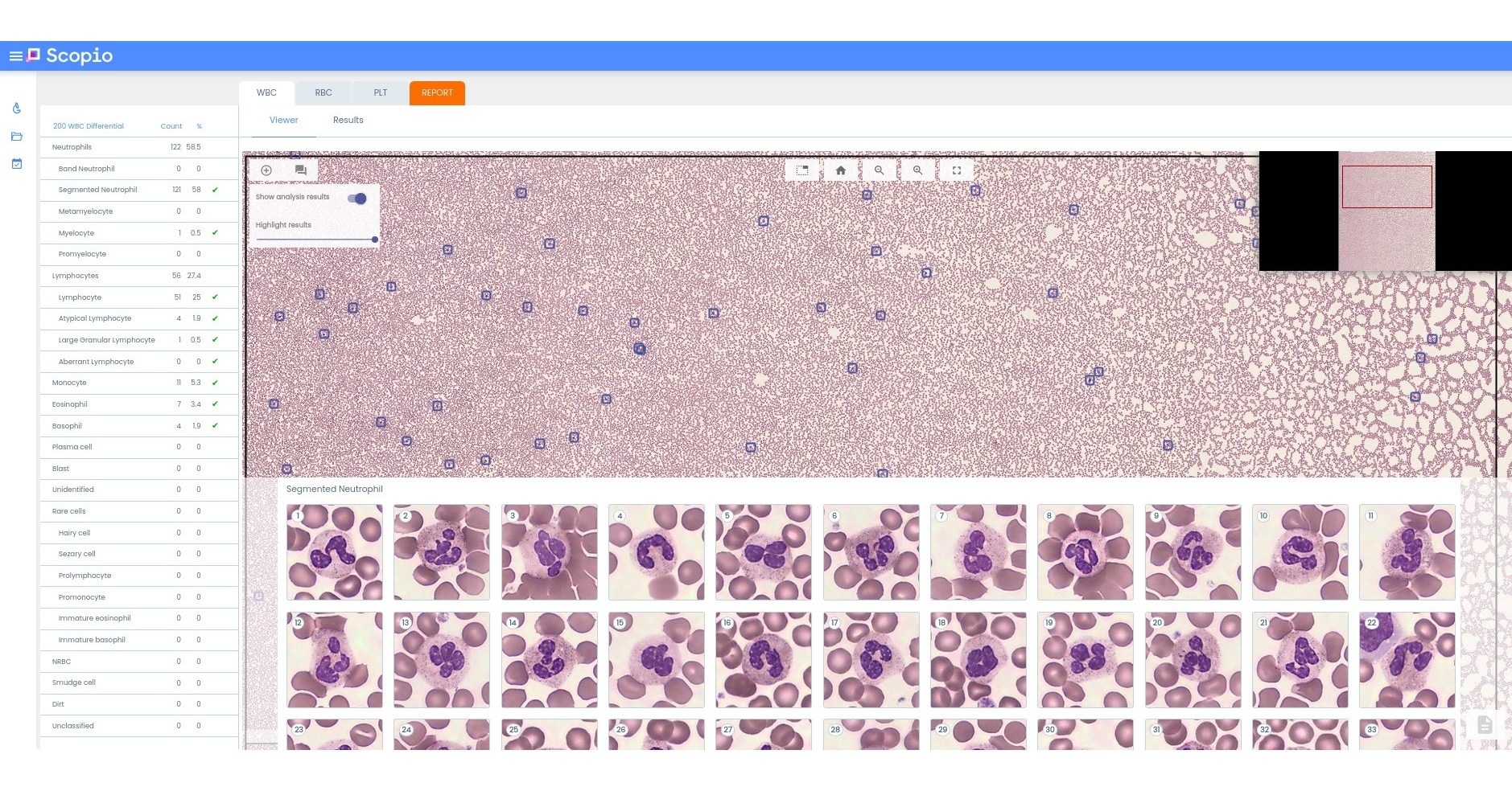 Scopio Labs Receives FDA Clearance for its AI-Powered Full Field ...