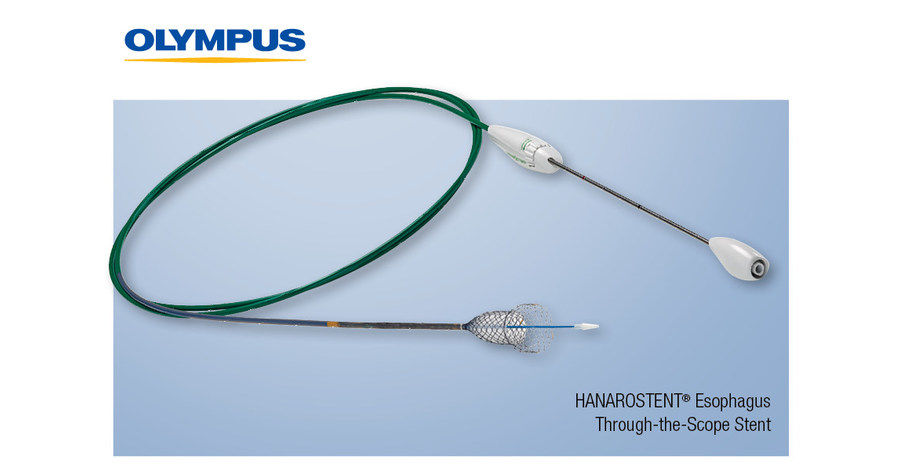 Olympus Launches HANAROSTENT Esophagus Through-the-Scope (TTS) Stent