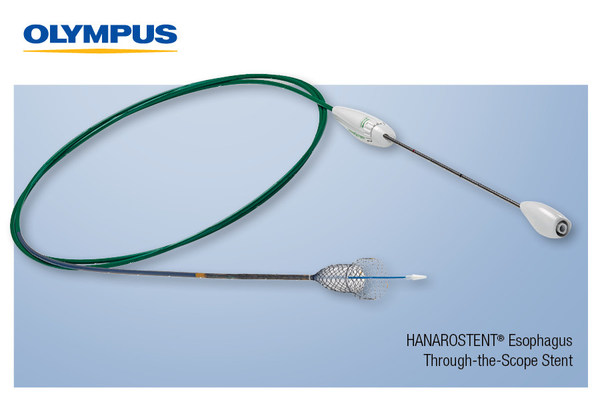 Olympus Launches HANAROSTENT Esophagus Through-the-Scope (TTS) Stent