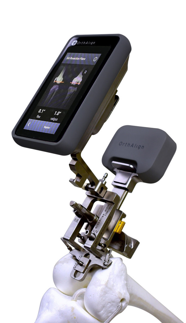 OrthAlign, Inc. Announces First Cases Using LANTERN™ Surgical Assistant ...
