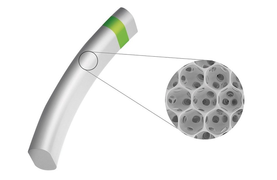 iSTAR Medical's glaucoma device MINIject shows positive one-year ...