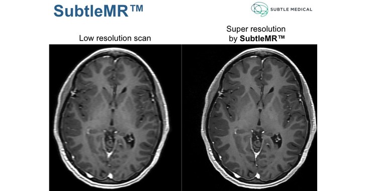 Subtle Medical Raises $12.2 Million in Series A Funding to Expand Its ...