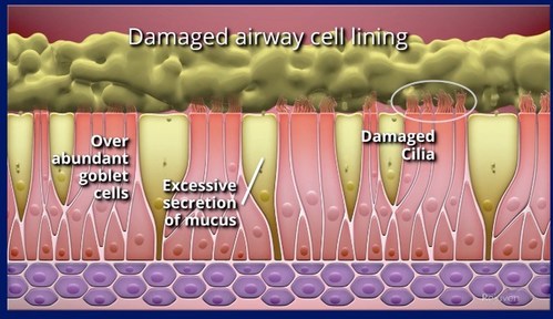 CSA Medical Announces Metered Cryospray with the RejuvenAir® System for ...