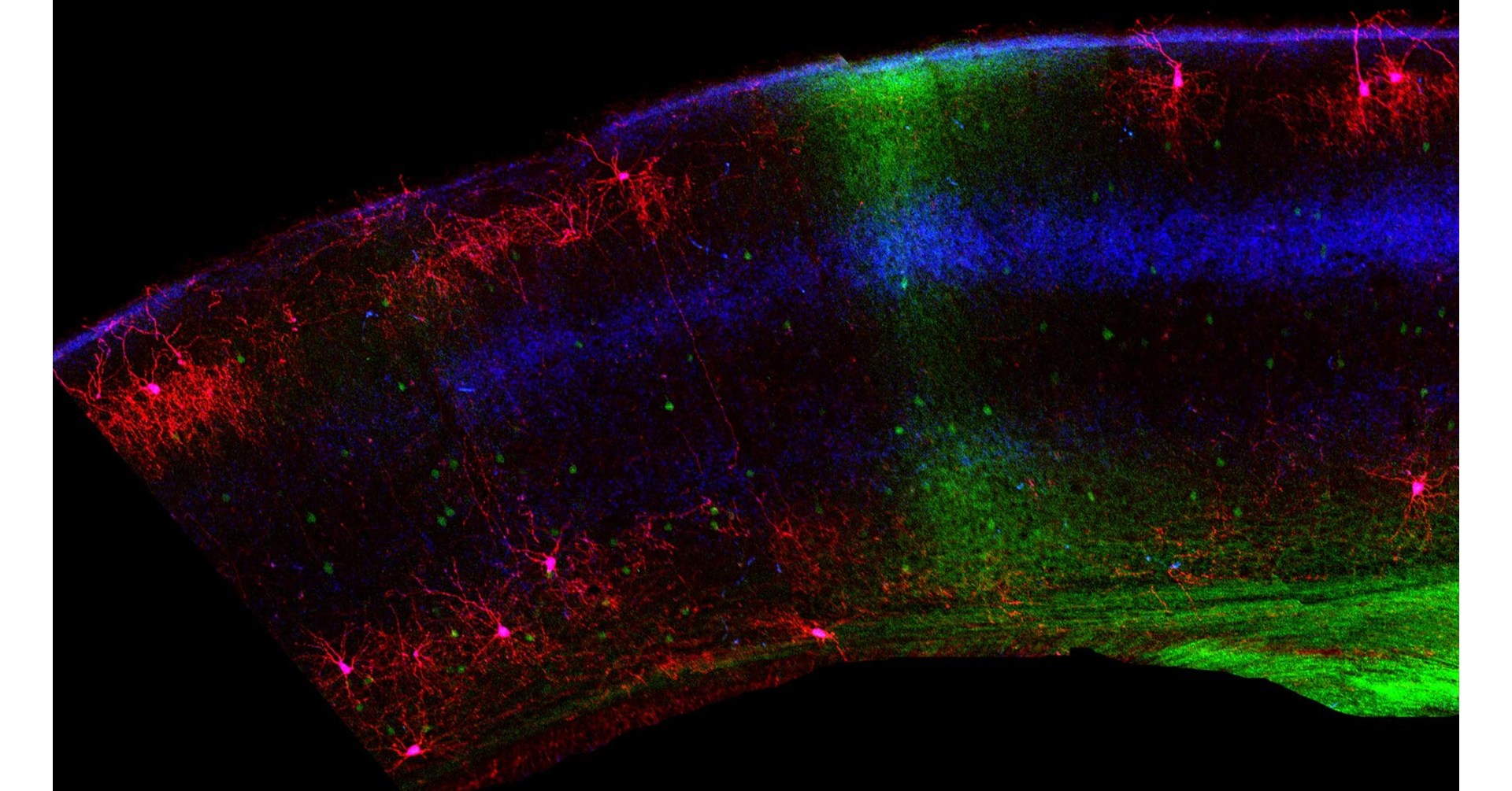 Problems with depth perception caused by too many cells