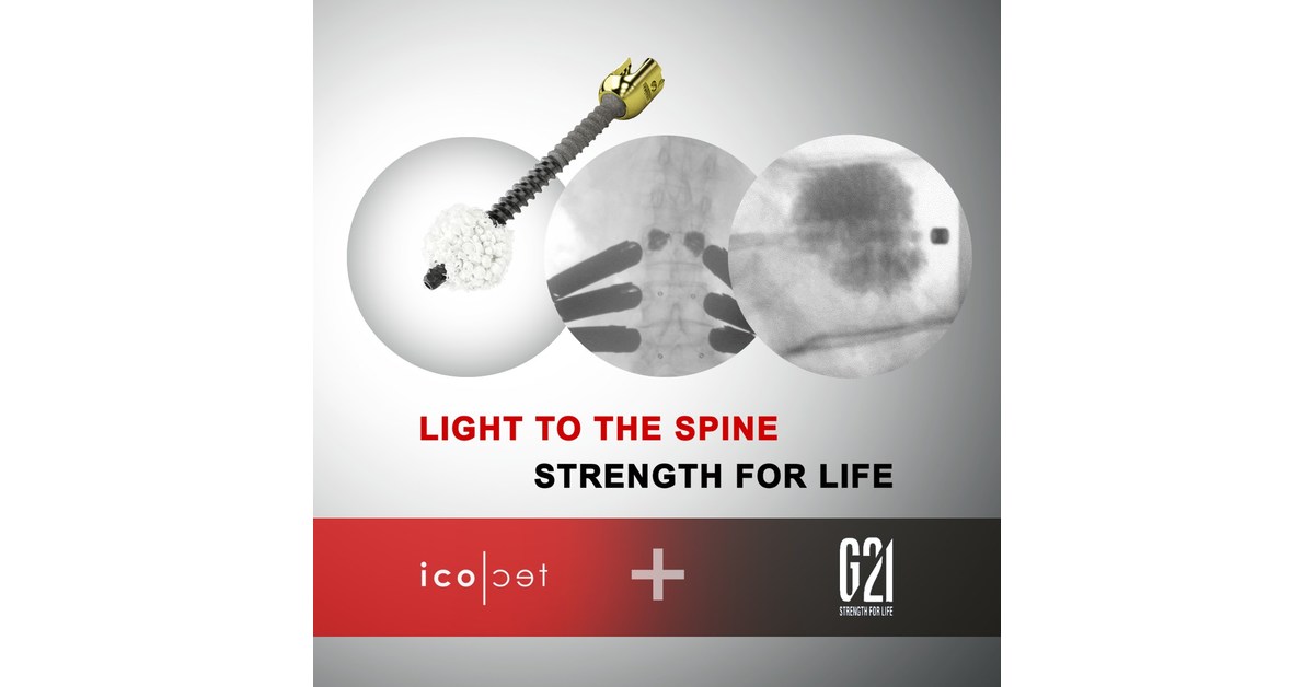 icotec ag Partners with G-21 to Provide Combined Bone Cement and ...