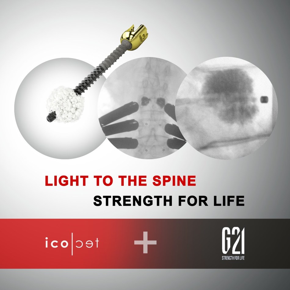 icotec ag Partners with G-21 to Provide Combined Bone Cement and ...